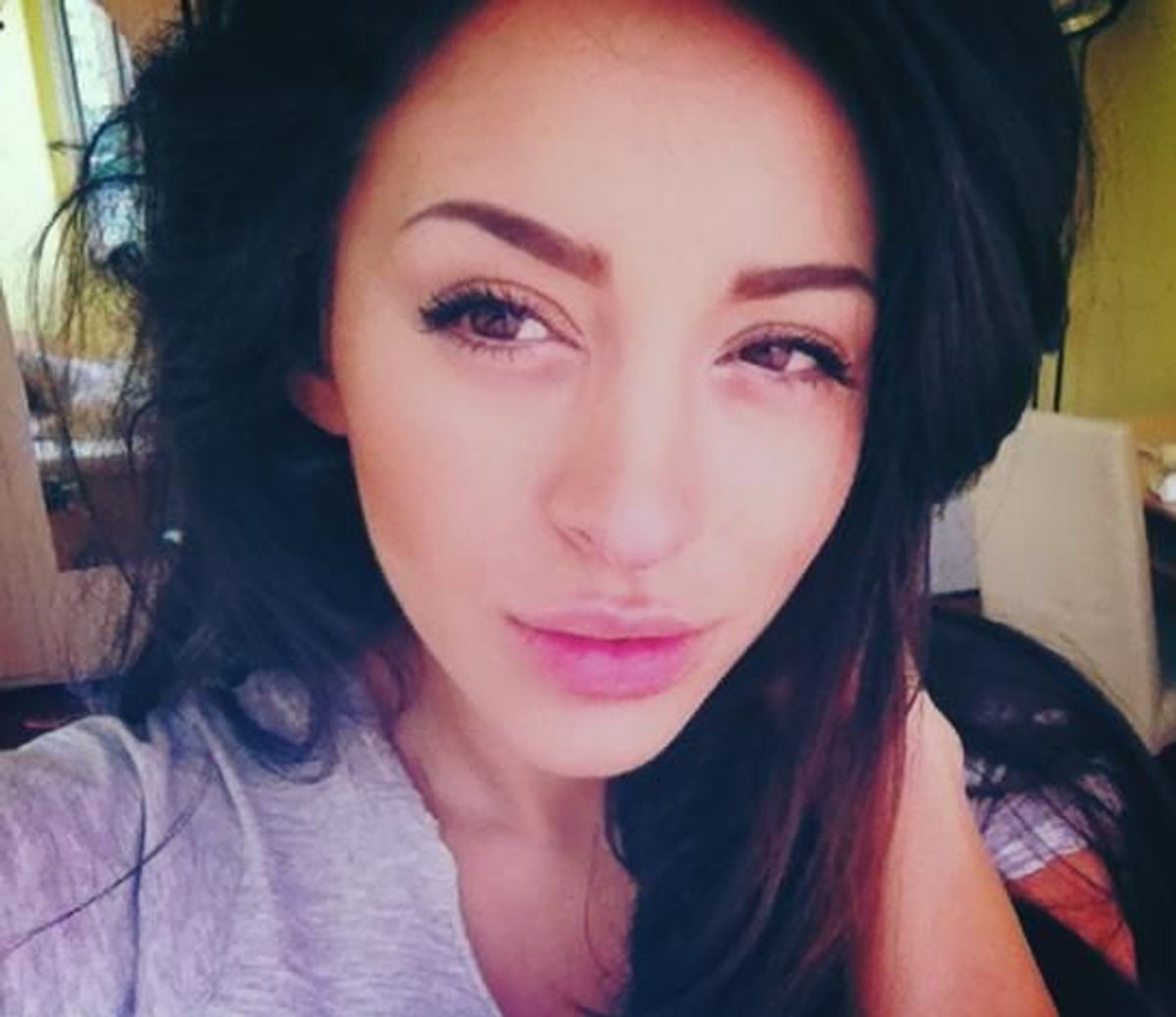 Ruby, accident la locul de munca. Cum arata piciorul ei, dupa o ...