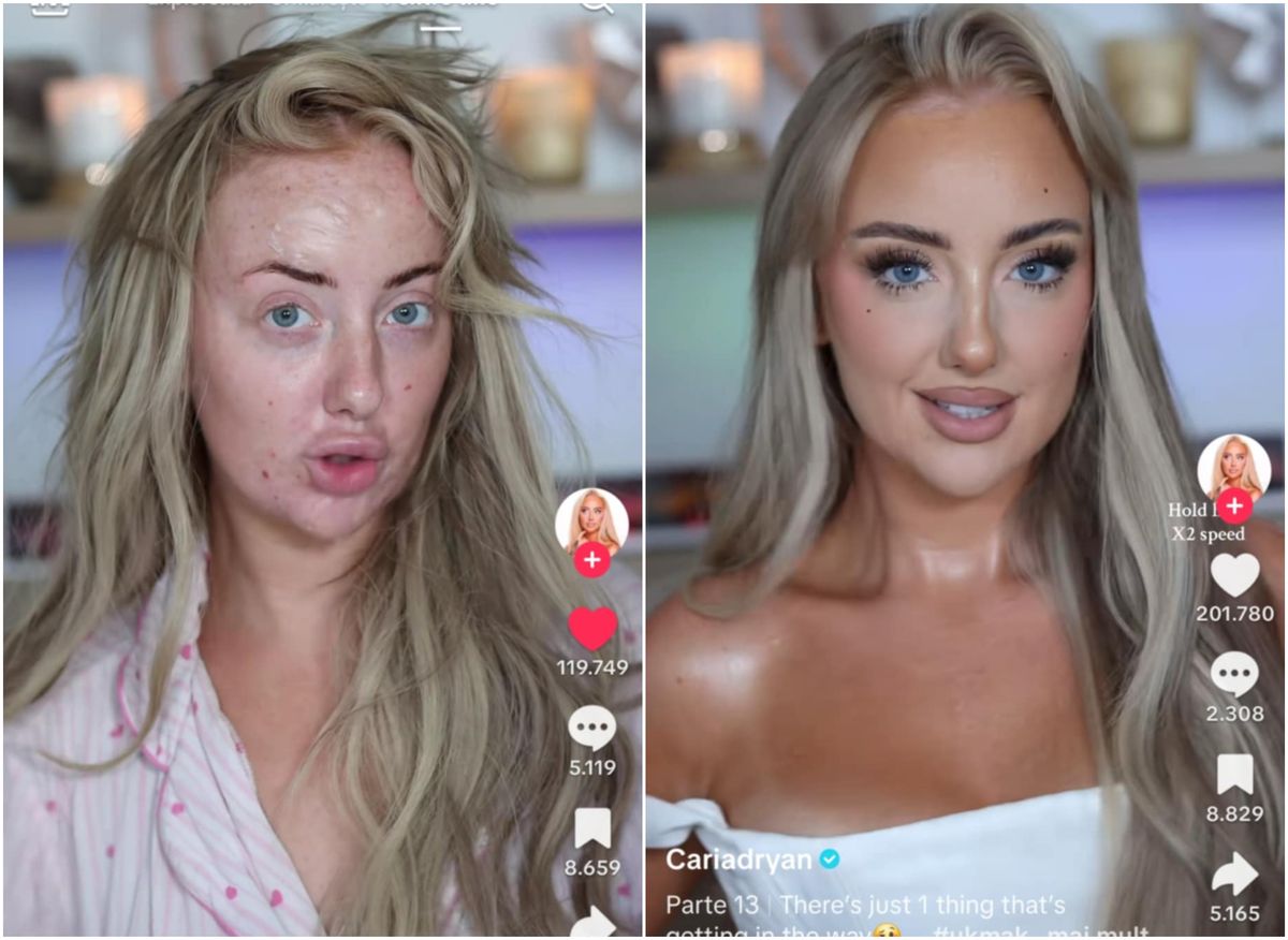 Transformare șocantă: de la acnee și imperfecțiuni la diva absolută ...