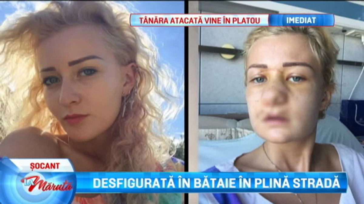 Desfigurata in bataie, in plina strada | Scene si bonusuri din La ...