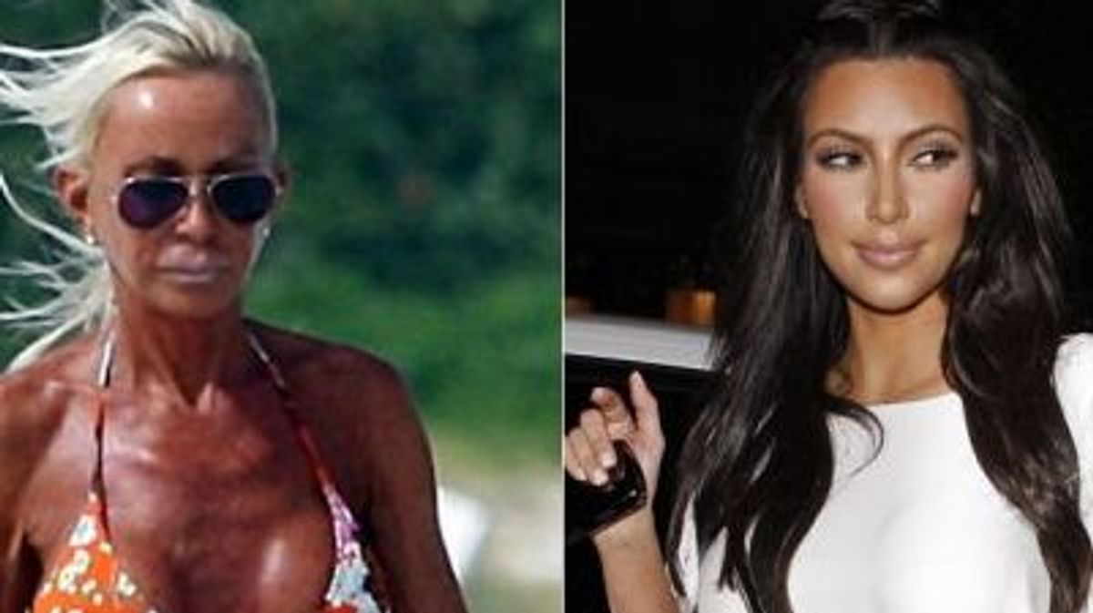 Topul vedetelor care si-au distrus pielea din cauza bronzului excesiv | PRO TV