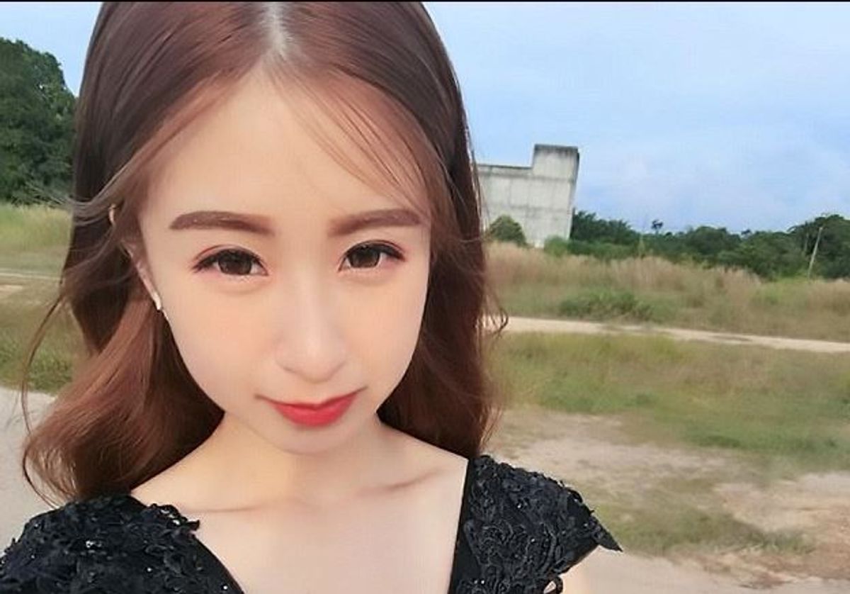 A avut curajul sa le arate oamenilor vergeturile rezultate in urma ...