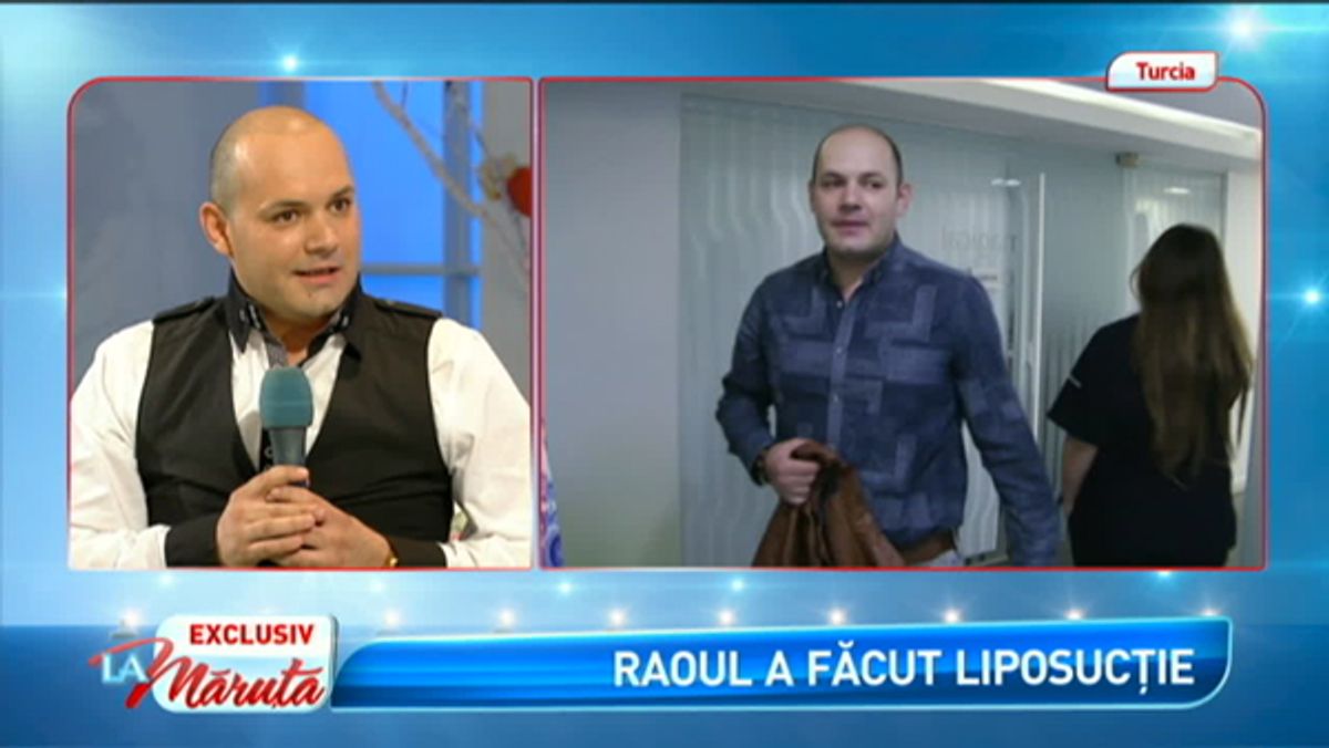 Raoul, despre procedura de remodelare la care s-a supus | Scene si ...