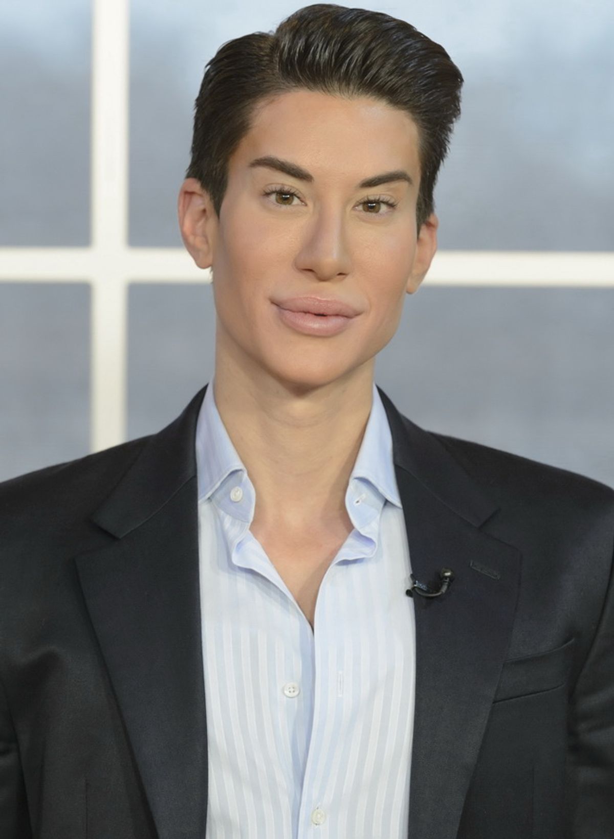 Drama barbatului cu 128 de operatii estetice. Prin ce a trecut cel ...