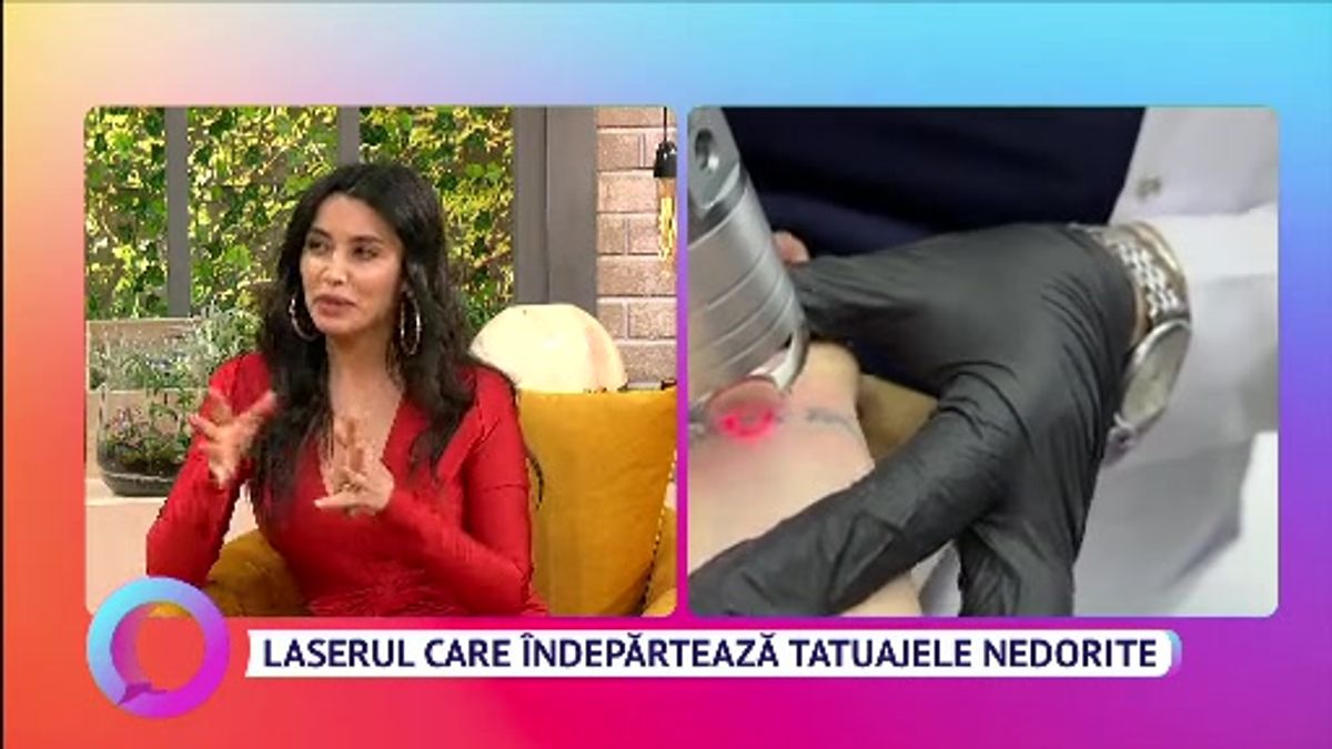 Laserul care îndepărtează tatuajele nedorite | Scene si bonusuri din ...