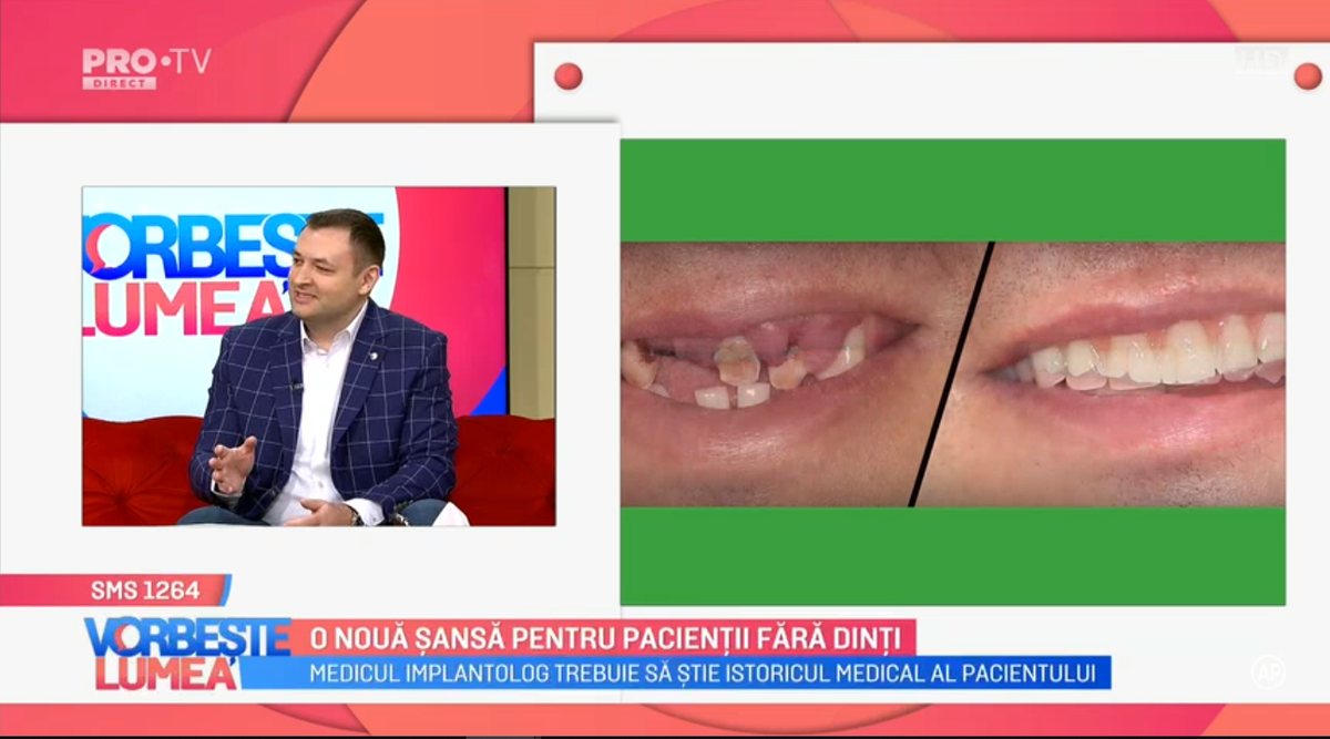 VIDEO Dr. Ionuț Leahu, despre implanturile dentare | PRO TV