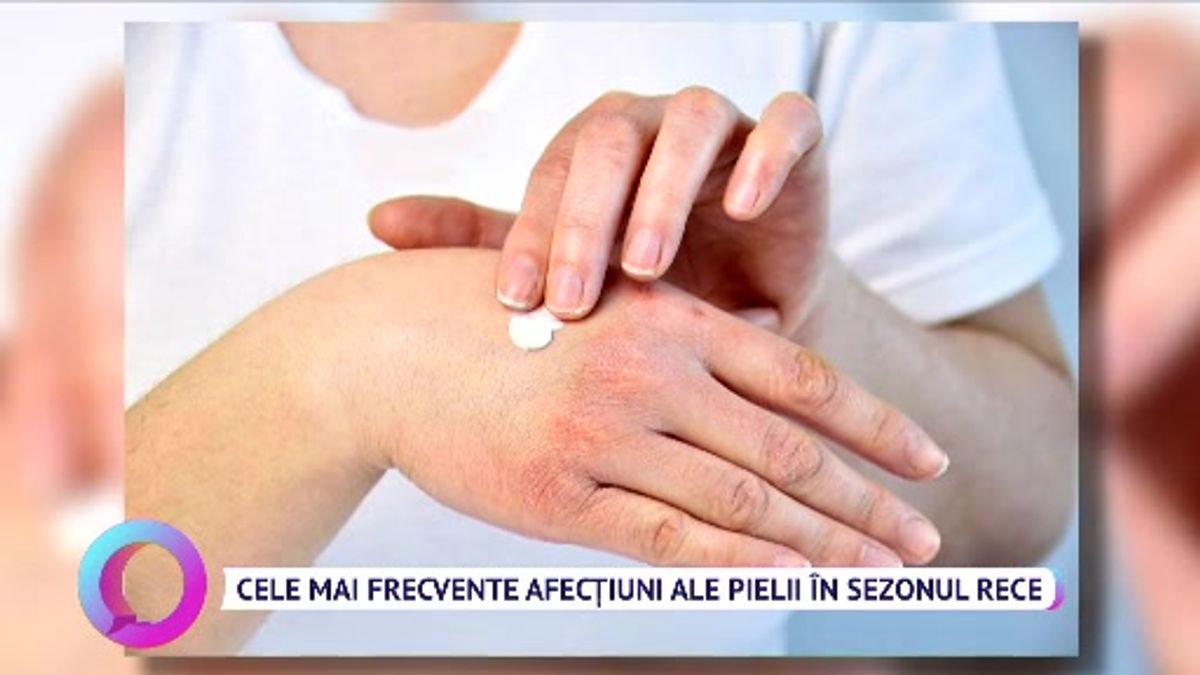 Cele mai frecvente afecțiuni ale pielii în sezonul rece | Scene si ...