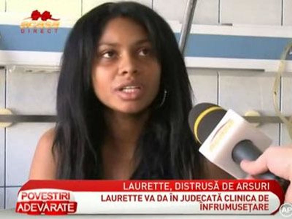 Laurette voia sa scape de vergeturi, dar a ajuns la spital cu arsuri de ...