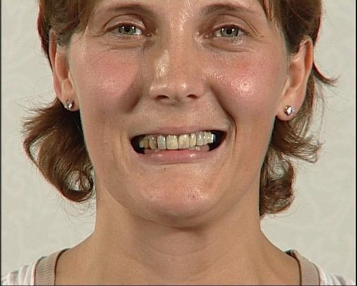 "Frumusete pe muchie de cutit", lider de audienta - VEZI EDITIA | PRO TV